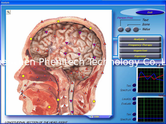 3d-nls quantum resonance magnetic body analyzer with free shippment