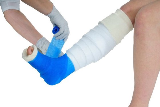 Fiberglass orthopedic casting tape