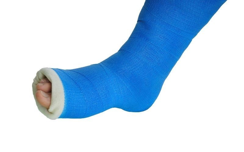 Ansen High quality fiberglass medical casting tape 4in/othoprdic products