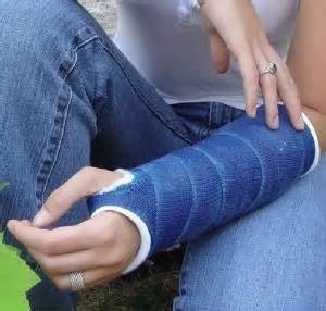 Colorful Surgical Adhesive Bandage Elastic Waterproof Fiberglass Casting Tape