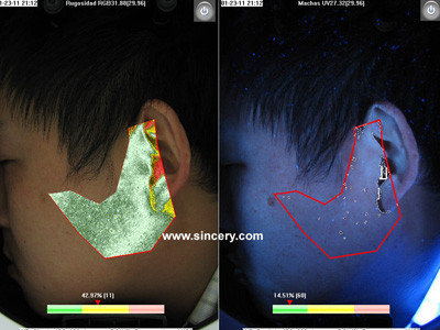 3: 4 Preview system, and Front slant window Facial Skin Analyzer Magic Mirror BS-3200 supplier