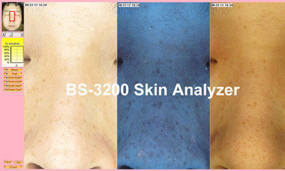 3: 4 Preview system, and Front slant window Facial Skin Analyzer Magic Mirror BS-3200 supplier