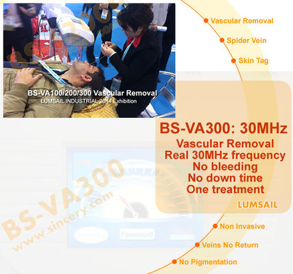 Vein Vascular removal vascular spider vein removal 30MHz high frequency beauty equipment supplier