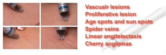 Vein Vascular removal equipment 980nm Spider Vein Vascular removal 980nm diode laser vascular removal supplier