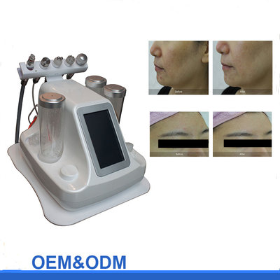 Jetpeel Oxygen dermabrasion diamond microdermabrasion portable microdermabrasion machine supplier