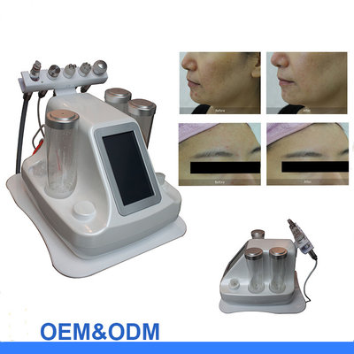 Jetpeel Oxygen dermabrasion newest silk peel machine dermabrasion for deep cleaning supplier