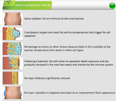 Cryolipolysis slimming equipment Cryolipolysis fat freezing slimming equipment supplier