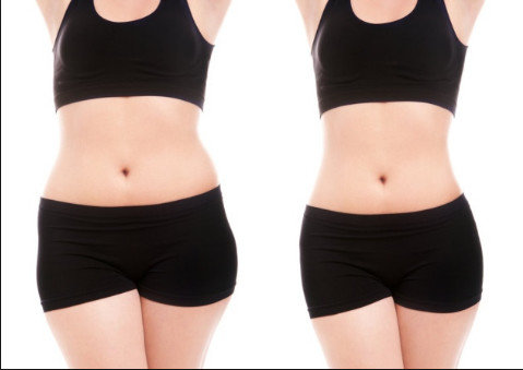 Cryolipolysis slimming equipment ODM&OEM cryolipolysis slimming fat freezing device cryo sculpture machine supplier