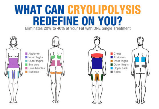 Cryolipolysis slimming equipment cryolipolysis slimming machine cryotherapy fat freezing supplier