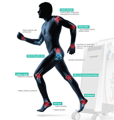 adjustable per 0.1Bar E.S.W.T Shockwave Device for plantar fasciitis treatment supplier