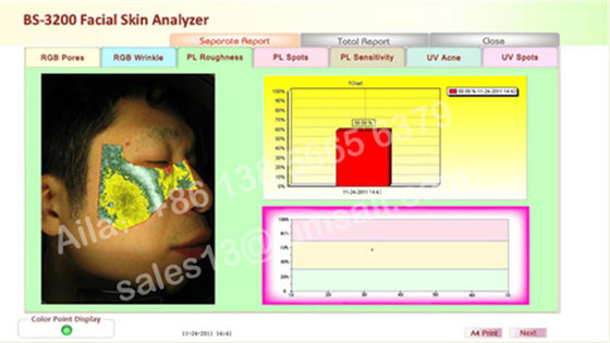 canon camera skin analyzer beauty equipment digital camera visia skin analysis machine supplier