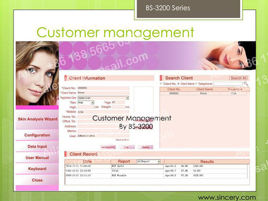 skin analzyer skin scanner Analyzer machine 15 megapixel Canon camera supplier
