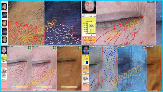 canon scanner ptz wired cameras dermatology skin moisture analyzer salon processor supplier