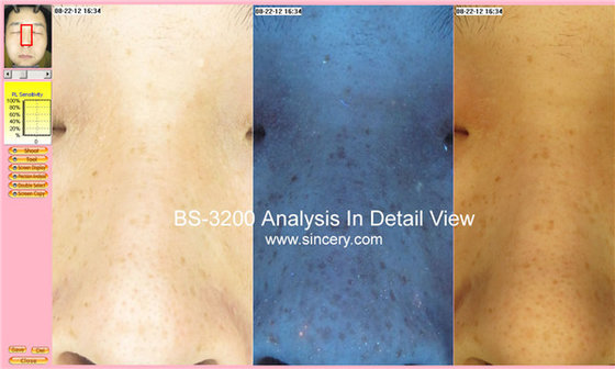 High quality 3d professional mini skin hair analyzer machines with English and Spanish version software supplier