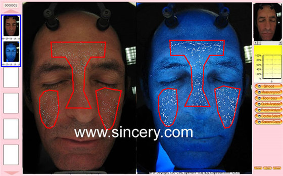 High quality 3d professional mini skin hair analyzer machines with English and Spanish version software supplier