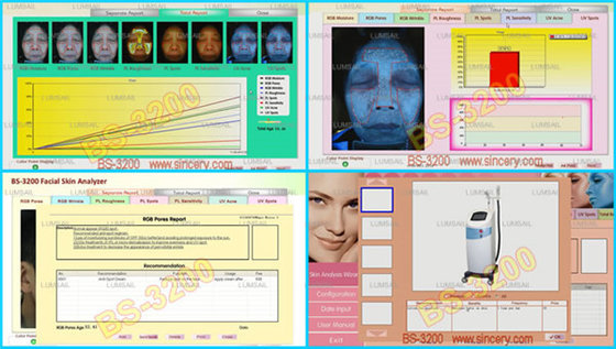 Compact Intelligent Skin Analyzer CE approved/facial analysis system supplier