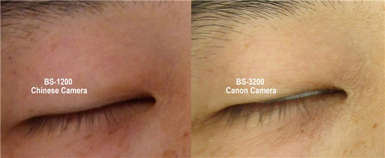 visia skin analyzer skin care analysis machine supplier salon beauty center supplier