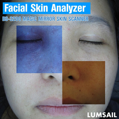 3D Facial reveal Skin Analyzer magnifier Machine for anti-aging analysis supplier