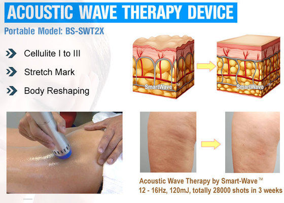 Body Beauty machine acoustic wave therapy machine for body slimming cellulite reduce supplier
