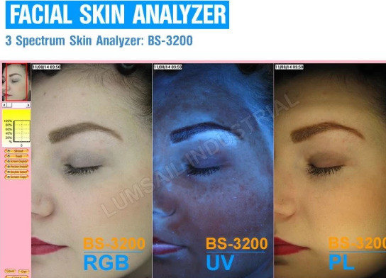 BS-3200 Analizadores Piel Canon Camera 3D Facial Skin Analyzer for Depth Area supplier
