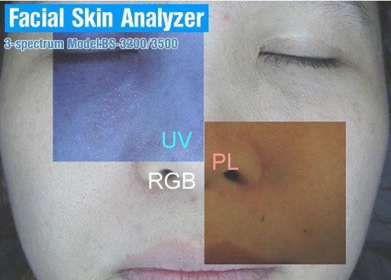 Mini 3D bs-3200 Skin Analyzer Machine Boxy Skin Hair Analyser supplier