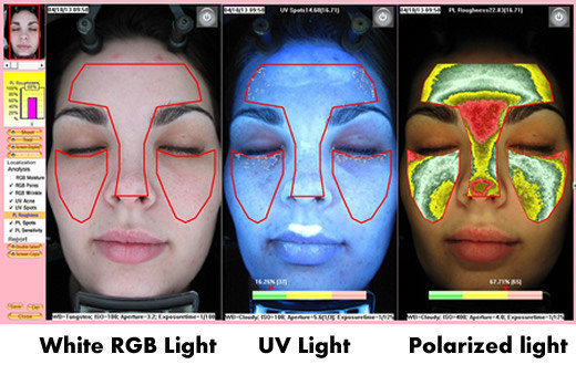 UV RGB Light Facial Skin Analysis BS-3200 Skin Analyzer supplier