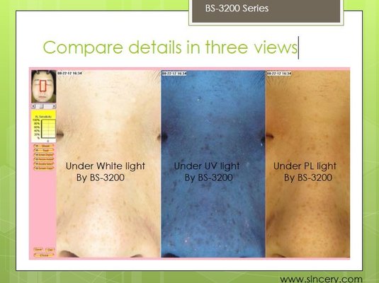 UV RGB Light Facial Skin Analysis BS-3200 Skin Analyzer supplier