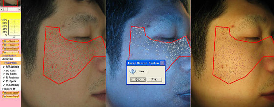 UV RGB Light Facial Skin Analysis BS-3200 Skin Analyzer supplier