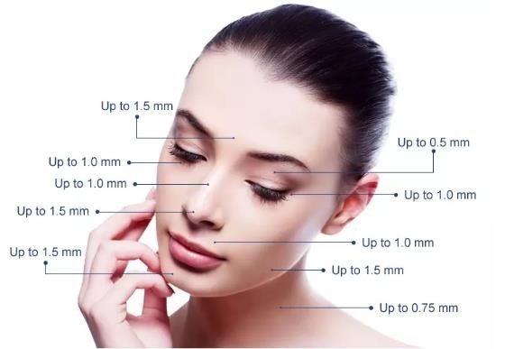 Professional Derme Roller 1.5mm Micro Needle Roller Dermaroller Derma Roller Titanium supplier