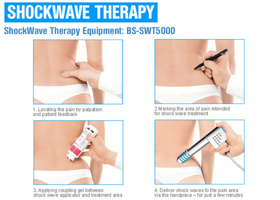 Professional clinic acoustic wave shockwave therapy machine for tibial stress syndrome supplier