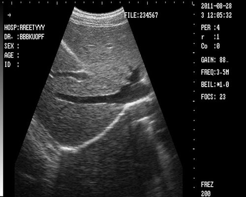 VET Portable Ultrasound Scanner with 18-month warranty/CE Ultrasonic with factory support/USG echo device/Sonography