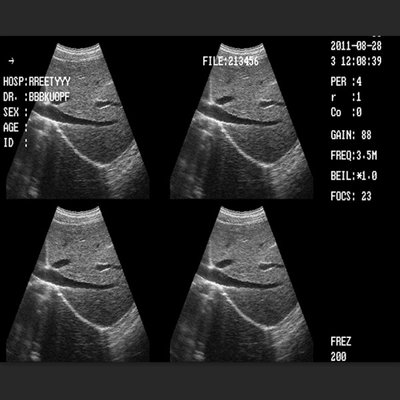 VET Portable Ultrasound Scanner with 18-month warranty/CE Ultrasonic with factory support/USG echo device/Sonography