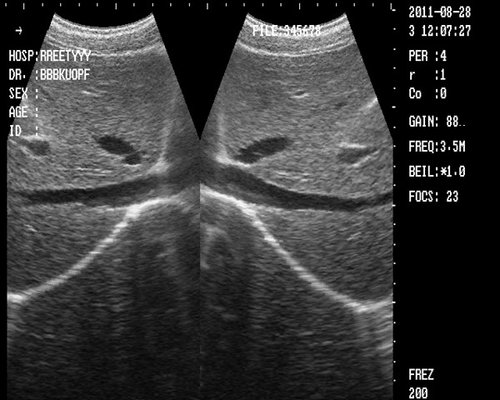 VET Portable Ultrasound Scanner with 18-month warranty/CE Ultrasonic with factory support/USG echo device/Sonography