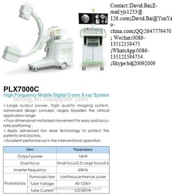 3D mobil digital C-are X-way system cone beam CT