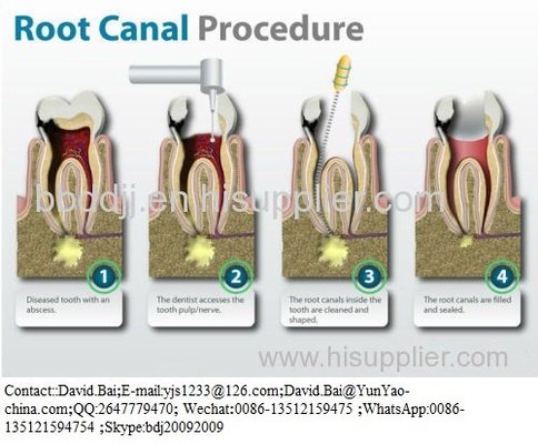 Dental Rotary Protaper /NITI Super Files for sale