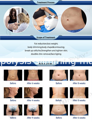 Hot selling multi-function CE approval  Cryolipolysis Slimming machine
