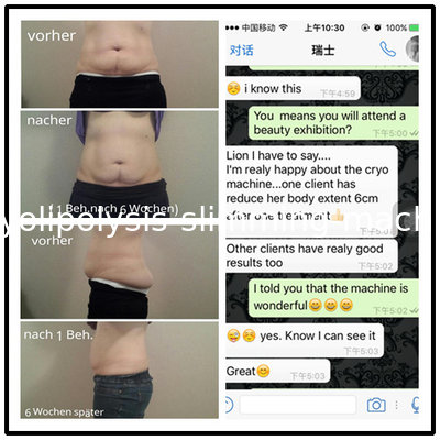 Wholesale good result five handles Cryolipolysis Slimming machine