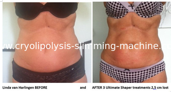 Promotion!!! Salon and spa use effective hifu body slimming machine