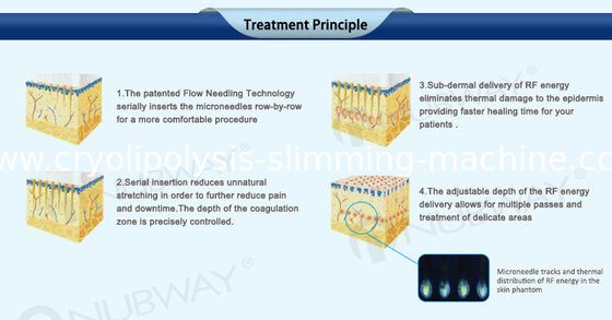 2018 hot selling effective result multifunctional face lifting Fractional RF microneedle machine with ce