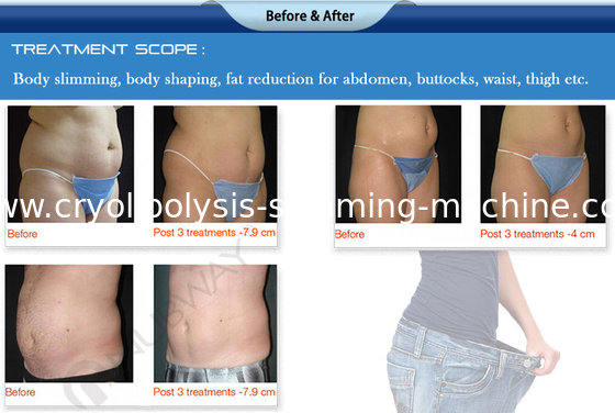 2018 Newest model most professional top selling best result HIFU slimming machine with ce