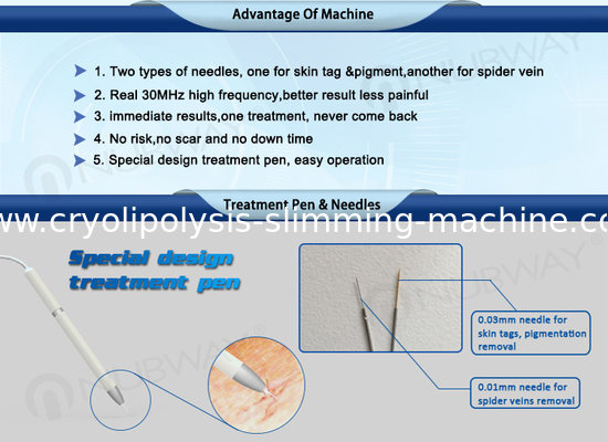Salon or spa used high quality and result professional 30.56MHZ Spider Vein Removal Machine