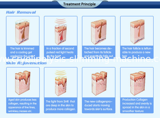 FDA approval multi-functional high quality factory price SHR E-light machine