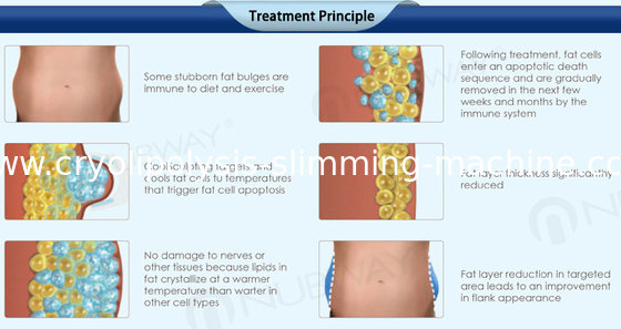 NUBWAY OEM 3 years warranty best result reduce 3-8cm Cryolipolysis Slimming Device