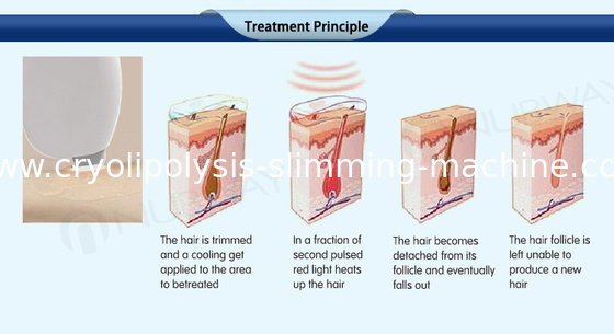 FDA approval OEM 3 years warranty 12*20mm big spot size 600W 808nm diode laser hair removal machine