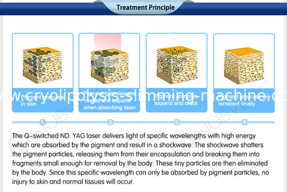 FDA approval best result factory price 6ns most professional ND-YAG pigment removal machine
