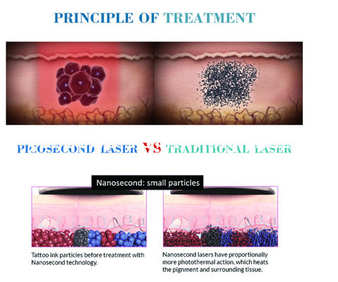 OEM ODM nubway factory price effective result 600PS strong power Pico laser tattoo removal machine