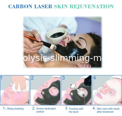 Nubway OEM ODM most professional 600PS 2-10HZ Picosure laser machine with ce