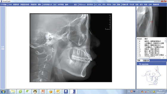 Associated Cephalometric Measurement Software for CBCT Cone Beam Computed Tomography Equipment