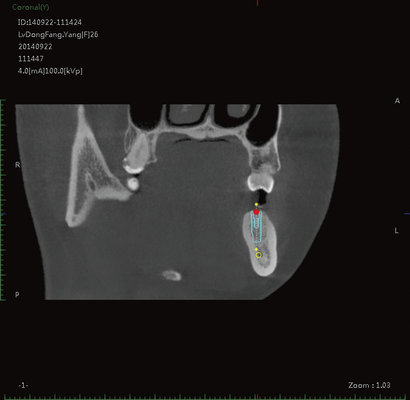 Medical Clinic Dental Imaging Systems 0.125mm 0.25mm 0.075mm Voxel Size