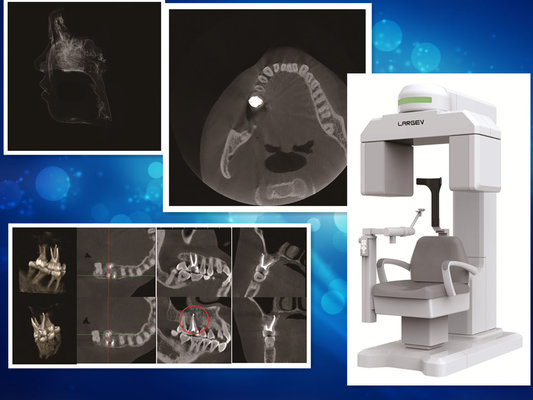 Ultra Low Dose Level Dental CT Scanner With Radiation Protection